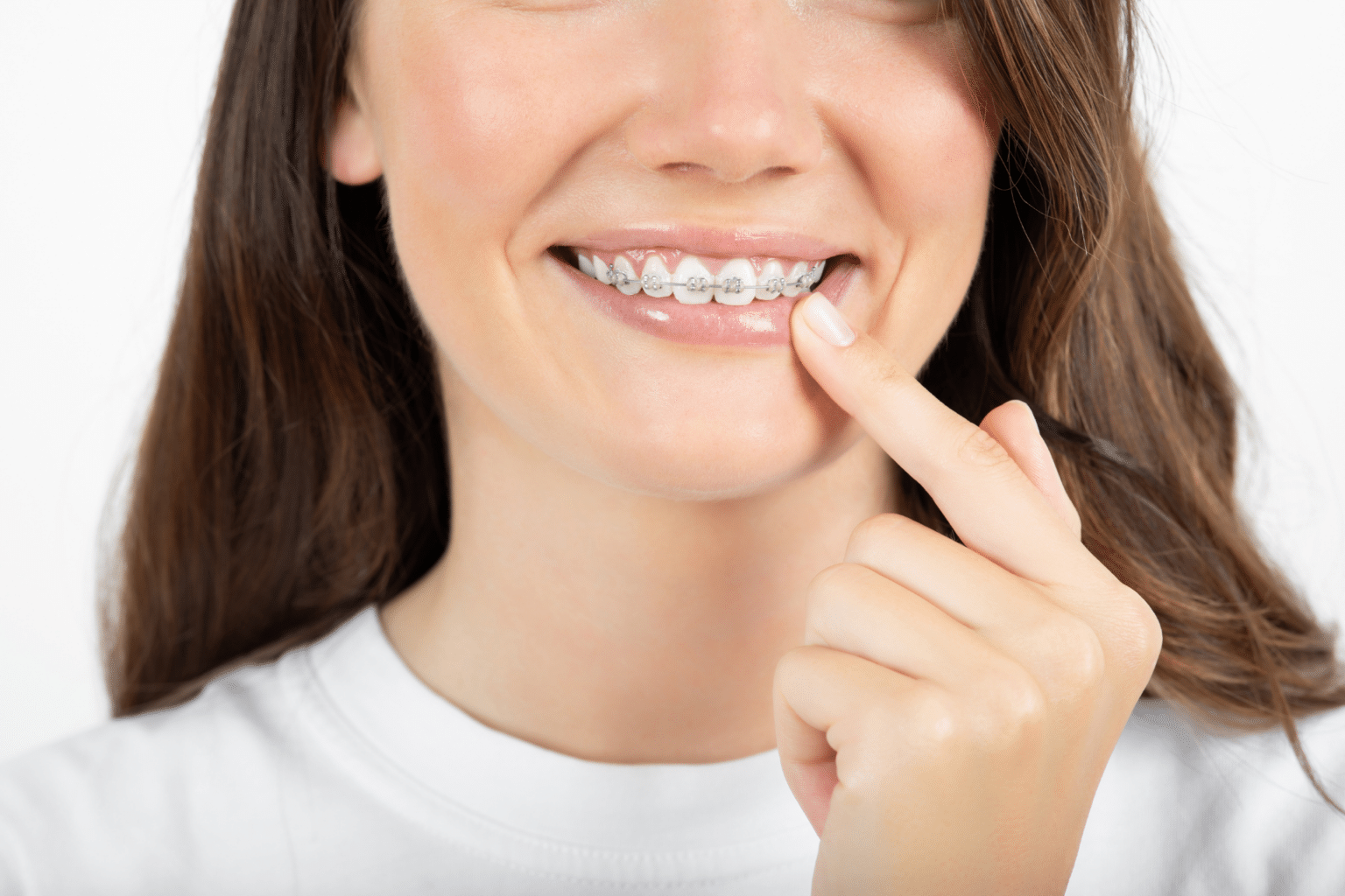 Fresh Breath With Braces and Invisalign: Easy Tips in Middletown and ...